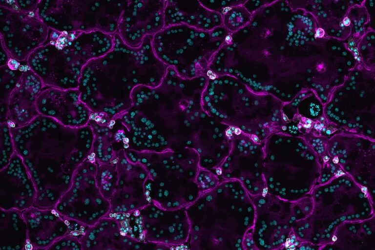 Bachelor of Science in Biomedical Engineering | Meinig School of ...